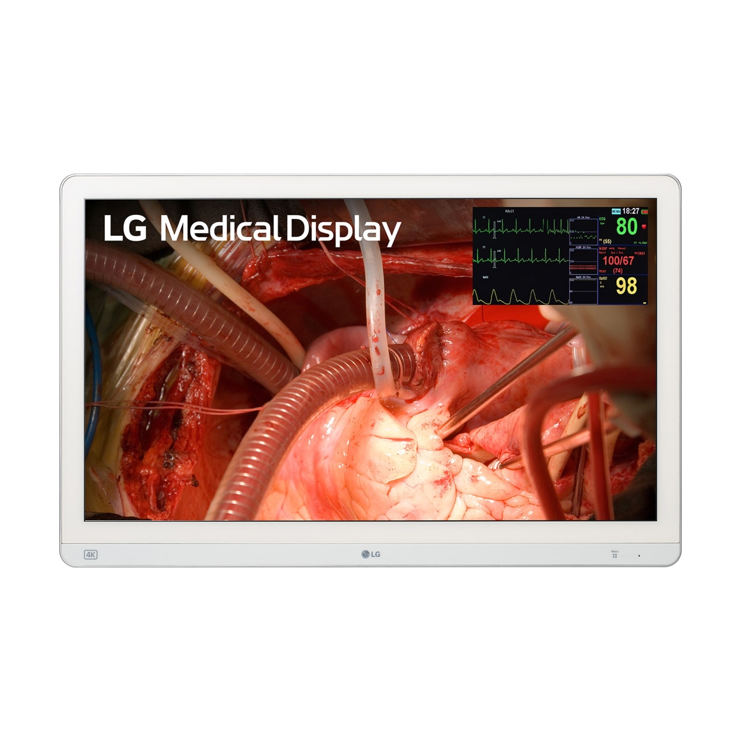 LG 의료용 디바이스 (의료용 영상출력기) | 27HQ710S-W | 모니터 | PC/모니터 | 제품/소모품 | LG전자